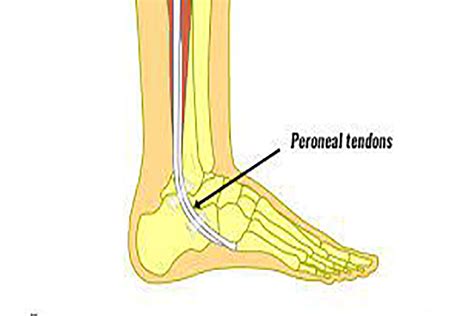 Podiatrists For Peroneal Tendon Surgery In Tuscany
