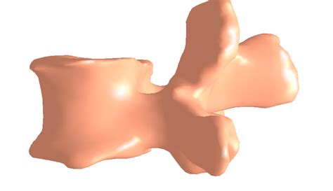 Comparisons With Coherent Point Drift 37 And Its Improved Variant 38