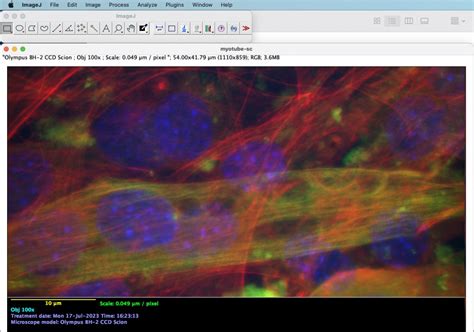 Image Analysis And Processing Tool Developments Using The Imagej Software Gilles Carpentier