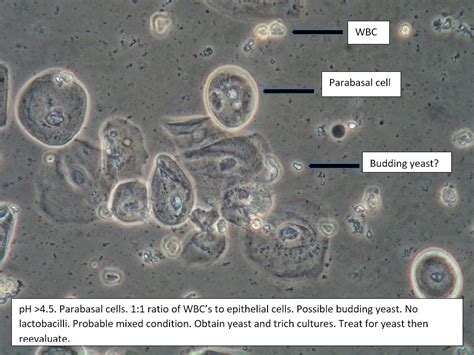 Vaginal Microscopy Summary Table B Findings Associated With Elevated Ph Vulvovaginal Disorders