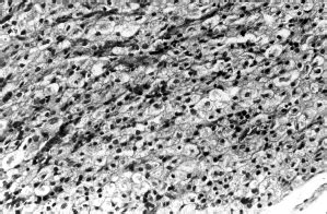 Cheek Pouch 15 Days Group 2 Lesion Of Inoculation Macrophagic
