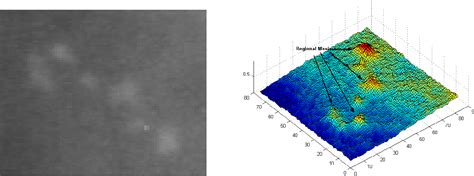 Figure 1 From Computer Aided Detection Of Clustered Microcalcifications