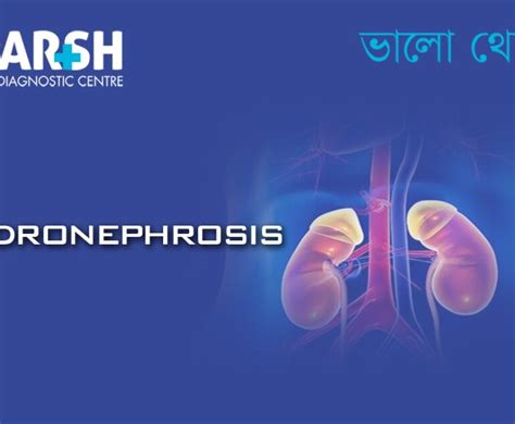 Wet Lung Sparsh Diagnostic Center
