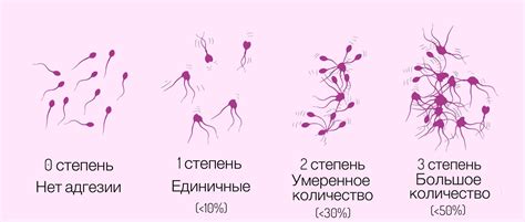Сперматозоиды: что следует знать о них - Reprolife Київ