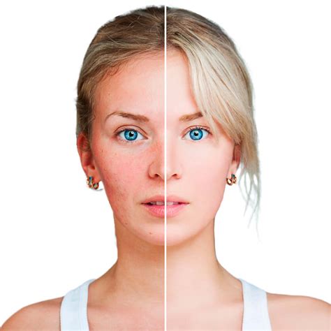 Ruddy Skin Tone Là Gì Tìm Hiểu Sắc Màu Da Hồng Hào Và Cách Nhận Biết