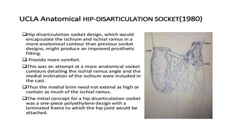 Hip Disarticulation Prosthetic Management Pptx
