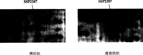 Application Of Thioredoxin Protein 2 Eureka Patsnap