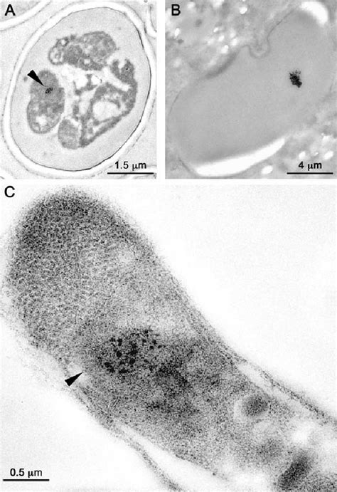 Cryptosporidium Parvum Microscope
