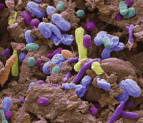 Gut Bacteria Sem Stock Image C057 6899 Science Photo Library