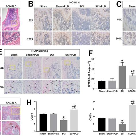 Effects Of Pld On Bone Morphology Bone Formation Calcium Deposition Download Scientific
