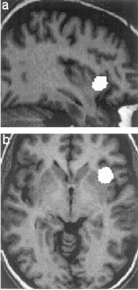 figure 3 from neural correlates of auditory visual stimulus onset