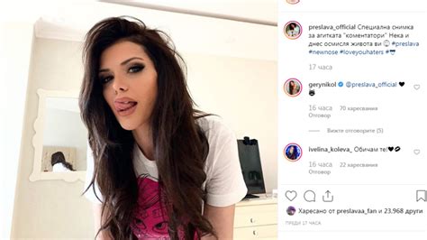 Появиха се снимки на Преслава на операционната маса Вижте как оперират носа й