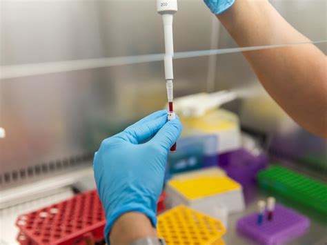 New Genotyping Recommendations Issued By Masac Nbdf