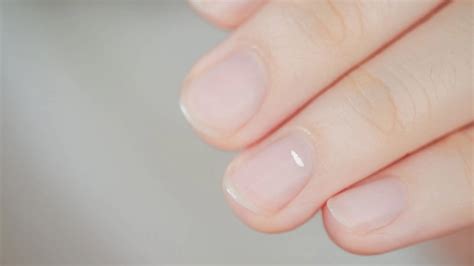 ¿por Qué Me Salen Manchas Blancas En Las Uñas Estas Son Las Posibles