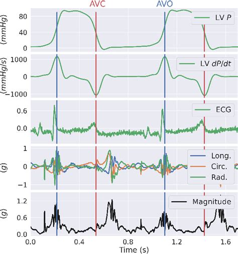 Figure 1 From Automatic Detection Of Aortic Valve Events Using Deep