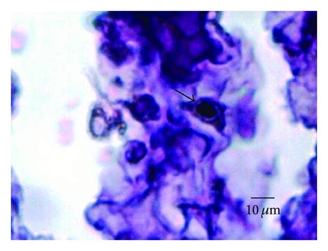 Osteocyte With Cytoplasm Extensions Inside Matrix Of Human Fetus At 16 Download Scientific