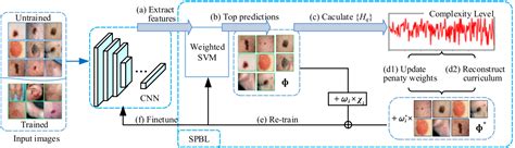 self paced balance learning for clinical skin disease recognition 程明明个人主页