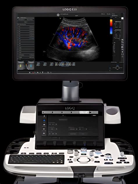 Ge Logiq E10 Ultrasound Machine