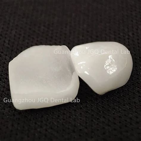 Perfect Fit Maxillary Mandibular Dental Porcelain Zirconia Veneers Emax