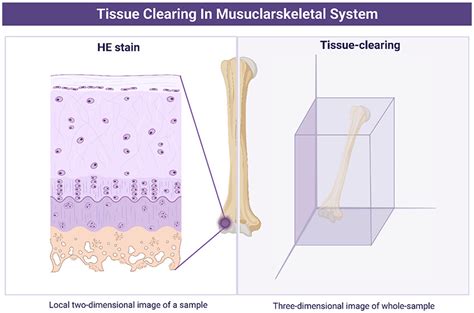 Tissue Clearing And Its Application In The Musculoskeletal System Acs
