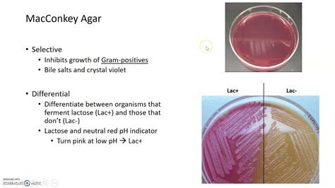 Selective And Differential Media 2 Youtube Selective And Differential Media 2 Youtube