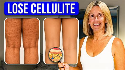How To Get Rid Of Cellulite And Thigh Fat For Older Ladies Youtube