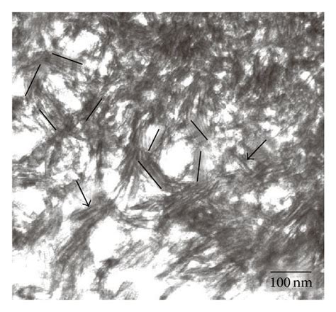 Nanostructure Of The Bone As Viewed By Electron Microscope 5 Taken