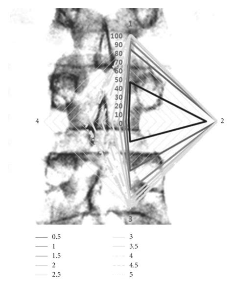 radar plots over a sample of lumbar spine anteroposterior view which