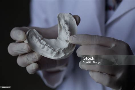 연구 진단 캐스트 및 치과 실험실에서 치과 석고 모델의 캐스팅 개방교합에 대한 스톡 사진 및 기타 이미지 개방교합 건강