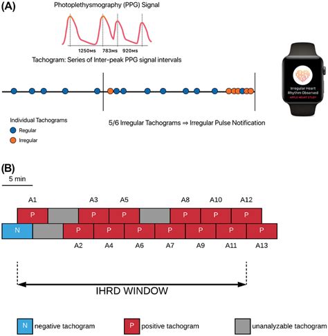 Photoplethysmography Ppg Based Arrhythmia Detection Algorithm Used In