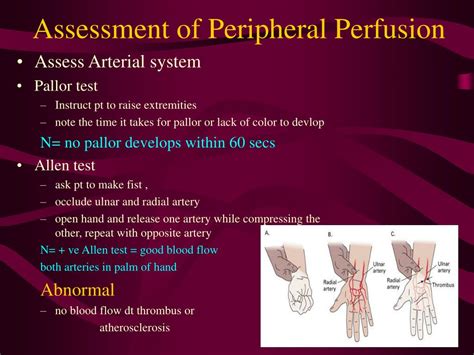 Ppt Heart And Peripheral Vasculature Powerpoint Presentation Free Download Id 5430304