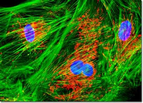 Molecular Expressions Microscopy Primer Specialized Microscopy