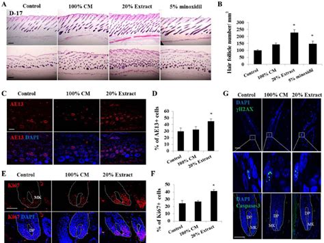 Hair Follicles And Matrix Cells Were Increased In Mice Treated With The