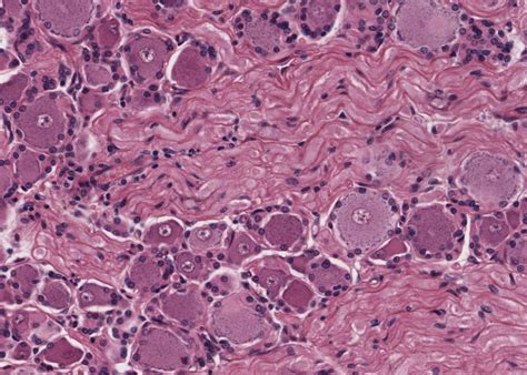 Spinal Ganglion Histology Identification Points