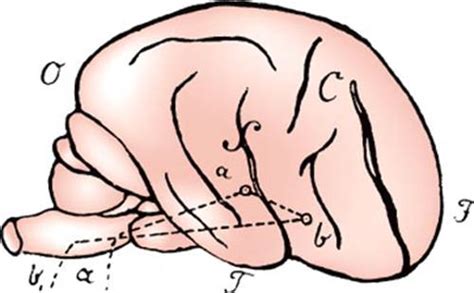 General Principles Of Neurologic Localization Localization In Clinical Neurology 6 Ed