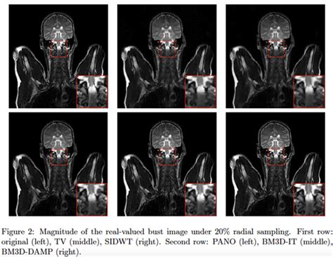 bm3d amp mri project page