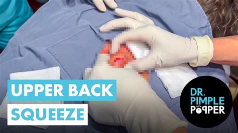 Upper Back Squeeze Youtube