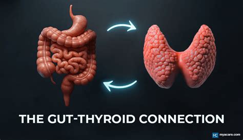 Gutthyroid Axis How Gut Health Impacts Hypothyroidism
