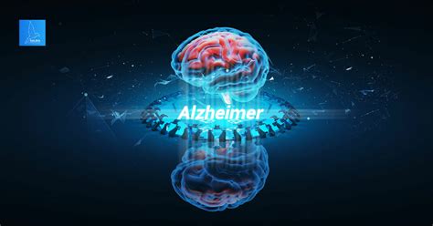 ข่าวดีวงการแพทย์ Ai สามารถทำนายโรคอัลไซเมอร์ได้ล่วงหน้านานถึง 7 ปี