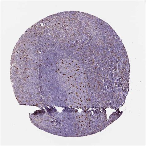 Tissue Expression Of Cd68 Staining In Tonsil The Human Protein Atlas