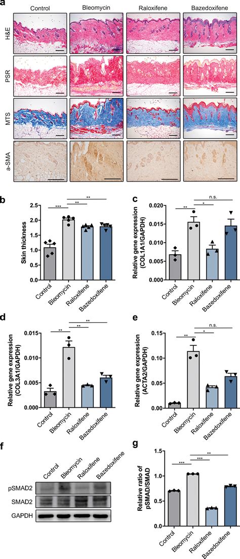 Anti Fibrotic Effects Of Raloxifene In The Bleomycin Induced Model Of Download Scientific