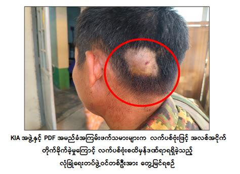 တပ်မတော်က ယာယီပစ်ခတ်တိုက်ခိုက်မှု ရပ်စဲရေး ထုတ်ပြန်ကြေညာထားသည့် ကာလအတွင်း Kia အဖွဲ့နှင့် Pdf အမည