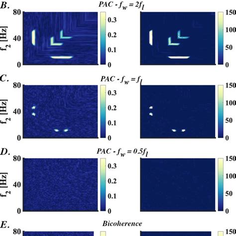 Phase Amplitude Coupling And Bicoherence In The Local Field Potentials