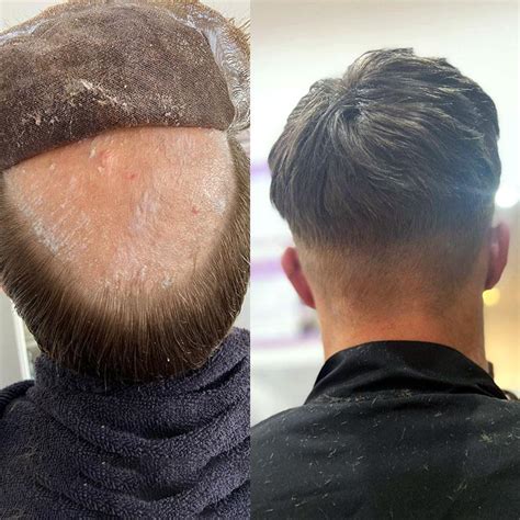 Hair Systems Before And After Toupee Hairstyles