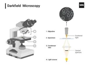 Different Types Of Microscopes With Principle Uses Diagrams Biology