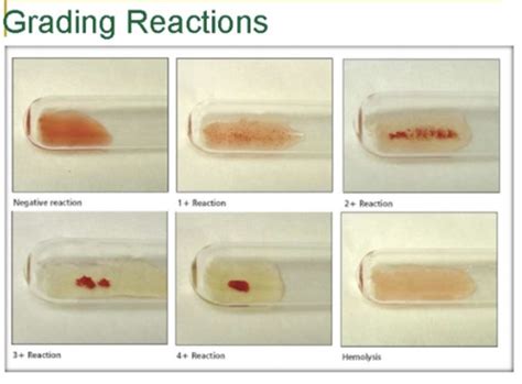 Blood Bank Lecture Exam 3 Flashcards Quizlet