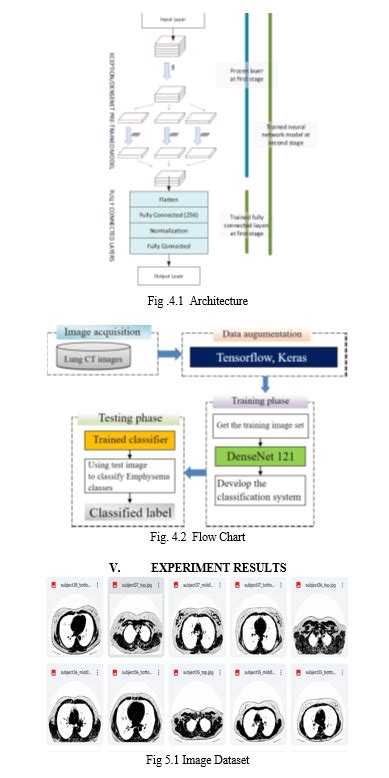 Early Classification Of Emphysema In Ct Scans Using Deep Learning