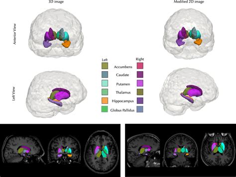 An Exemplar 3d Visualisation Of The Successful Segmentations Of The 3d Download Scientific