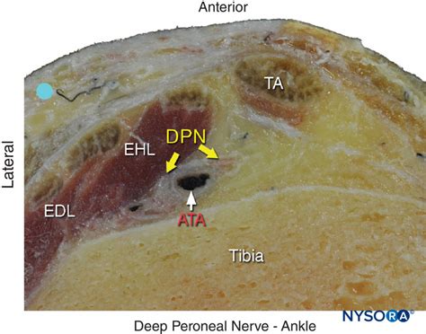 Regional Anesthesia Cross Sectional Anatomy Of The Deep Peroneal Nerve