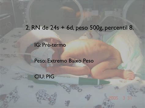 Ppt Classificação Do Recém Nascido Powerpoint Presentation Free